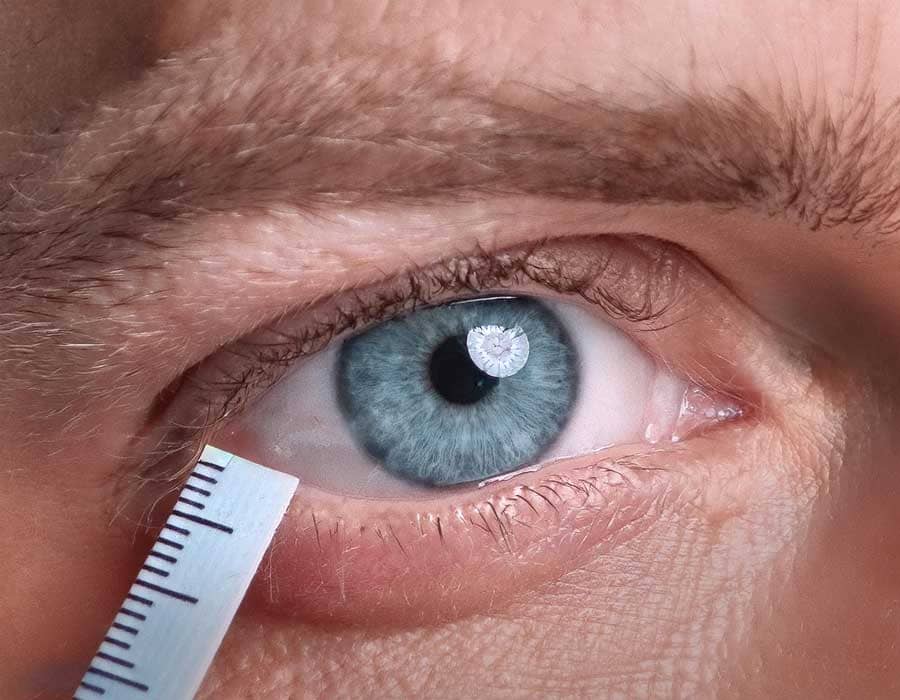 Sécheresse Oculaire : Causes Et Traitements Pour Yeux Secs